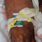 Tourni-Key - Defibrion